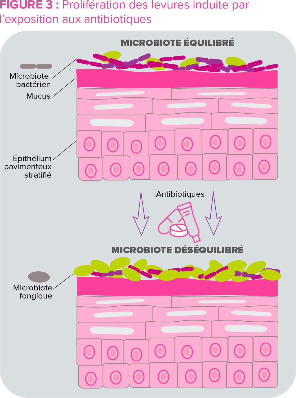PATHOLOGIE BACTERIENNE ET MYCOSES