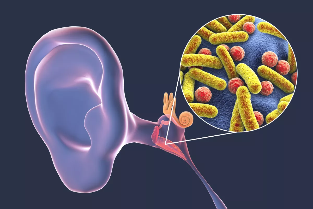 Does the nasal microbiota modulate the risk of otitis? | Content for ...