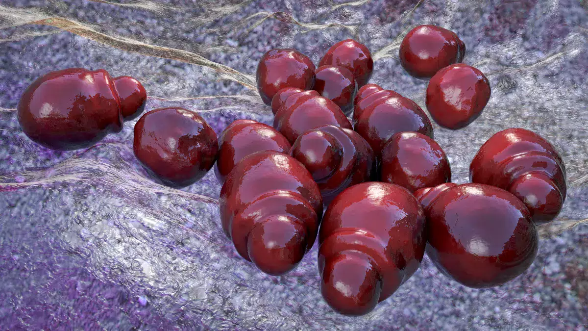 Atopic dermatitis: skin mycobiota under the microscope | Content for ...