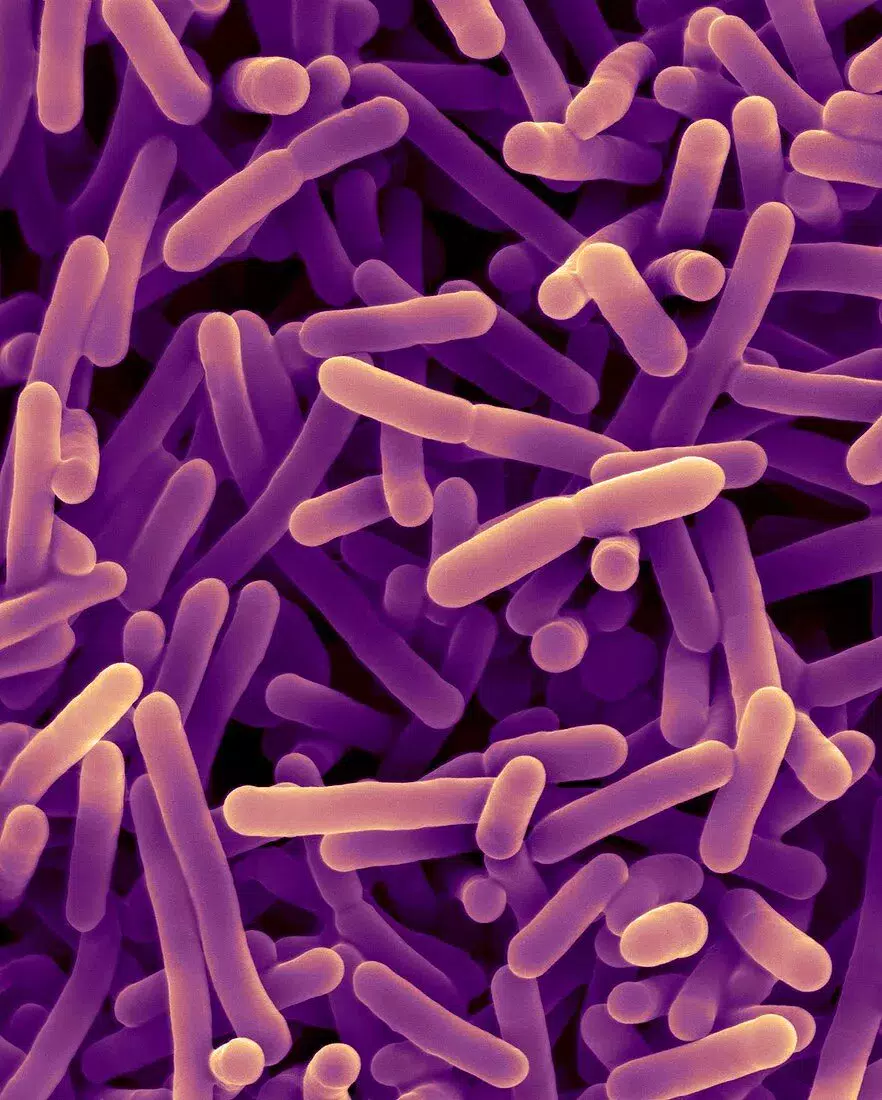 bifidobacterium