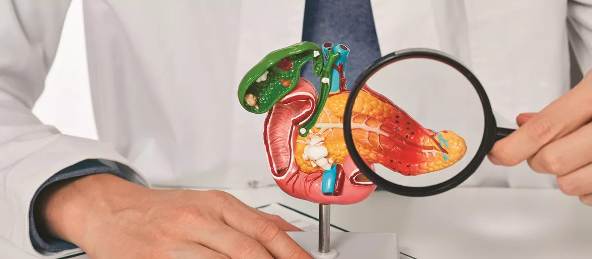 Pancreatic cancer: oral microbiota could predict risk | Content for the ...