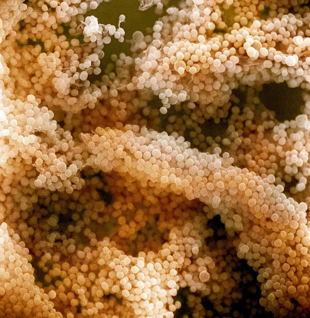 S.aureus et démangeaisons : Les dessous du mécanisme d'action de cette ...