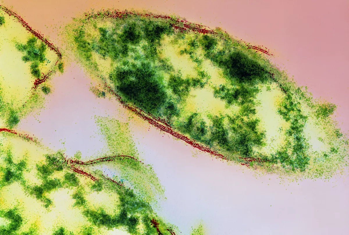 De la boca al colon: en pos de la ruta de la Fusobacterium | Contenido ...