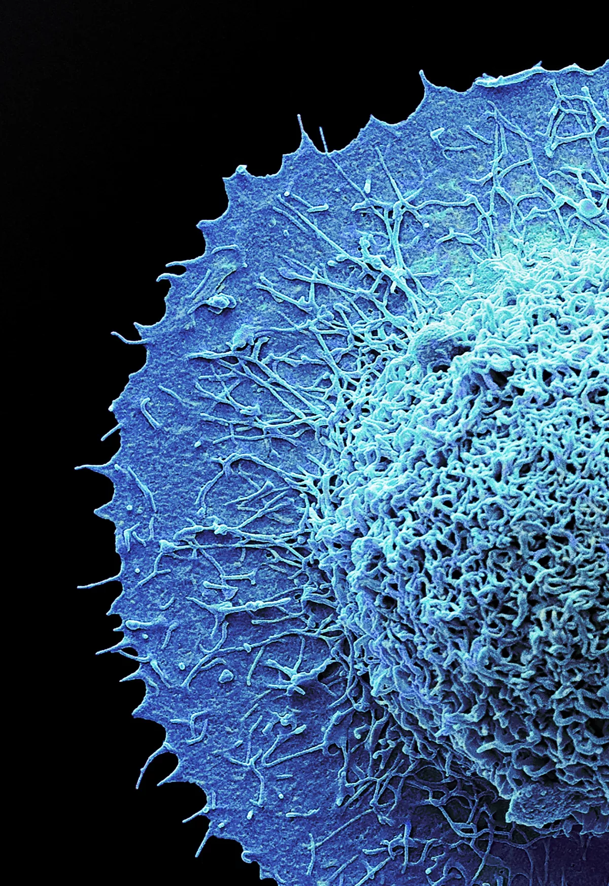 The microbial-metabolic nexus in colon cancer | Content for health ...